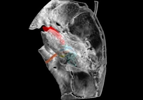 3D reconstruction of cochlea - Steroviz Pixels